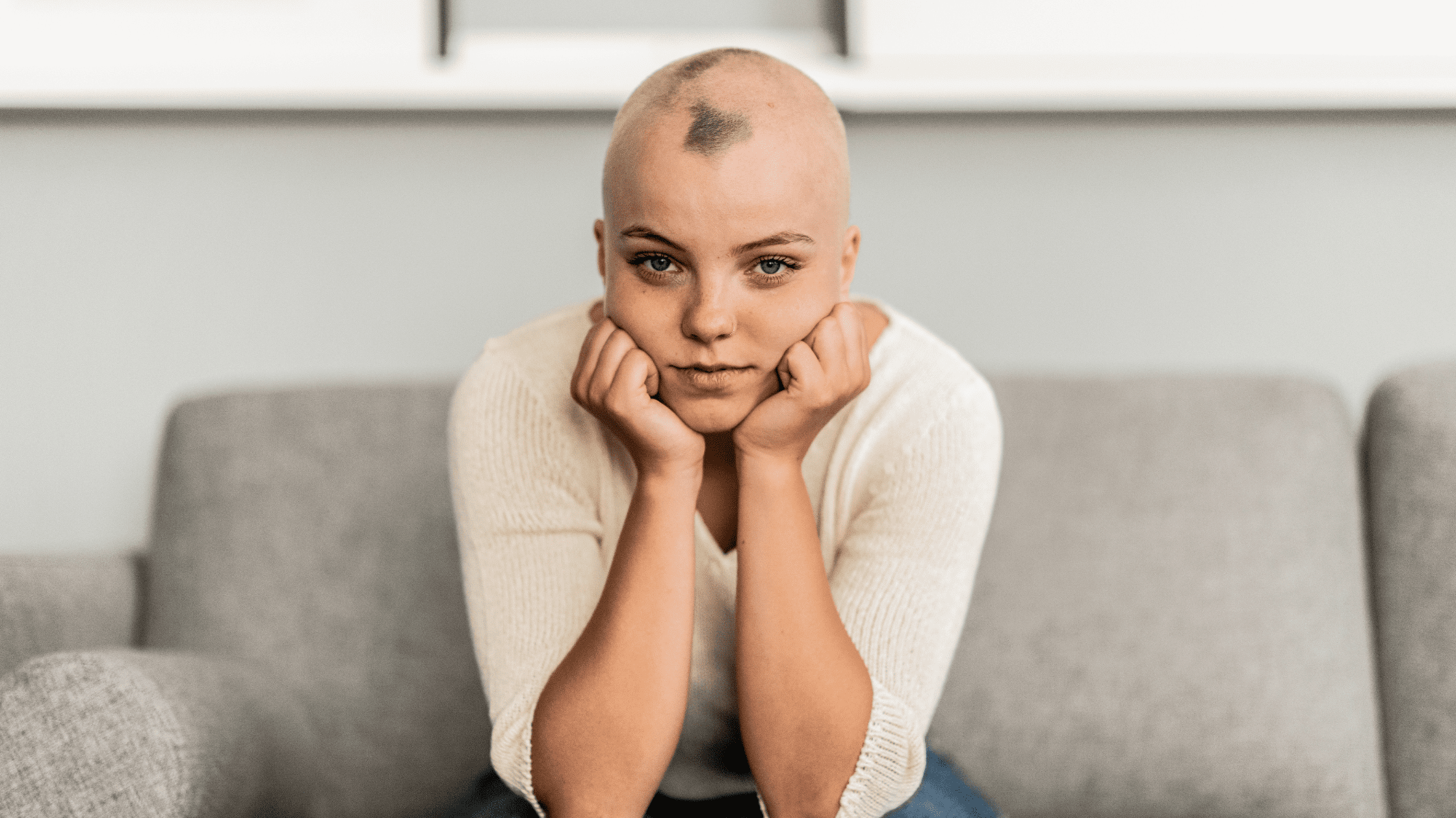 What are the Signs of Alopecia? - tapGP